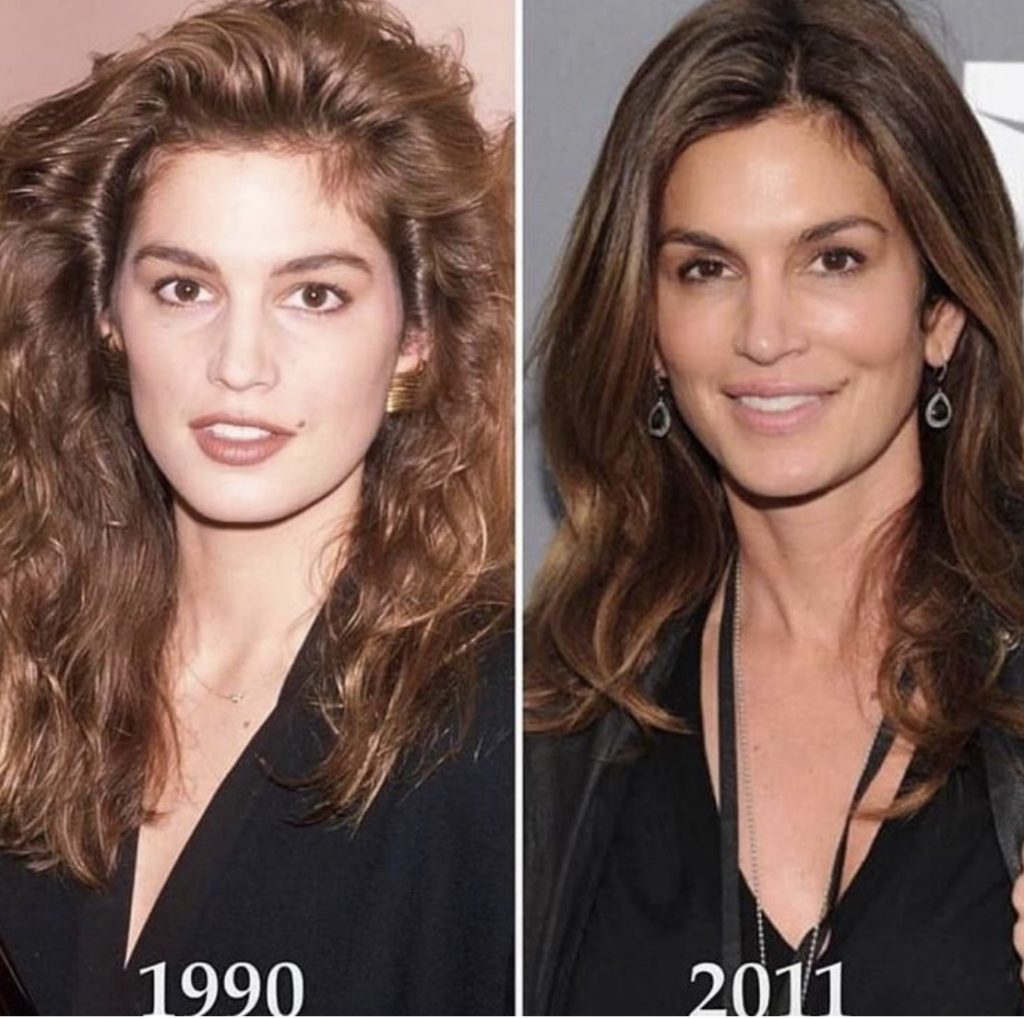 Botox: Beyond The Basics - Nova Aesthetic Clinic